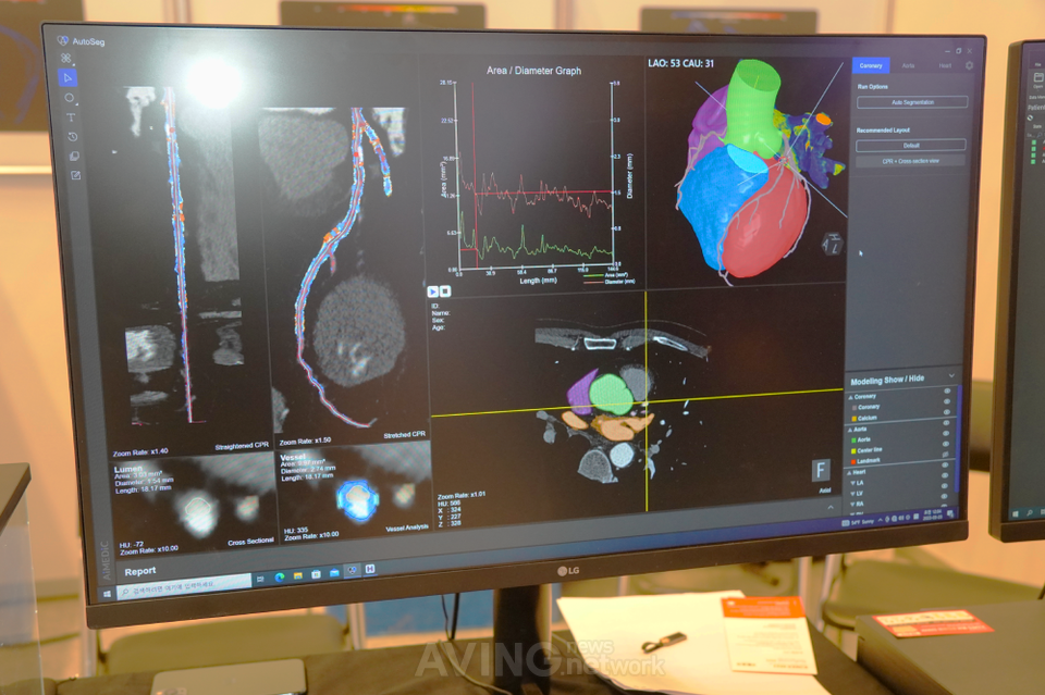 AIMedic introduces AI-based 2023D heart modeling software 'AutoSeg' at ...